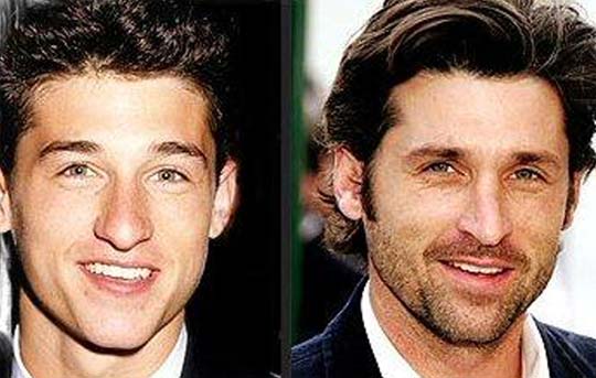 Patrick Dempsey Nose Job