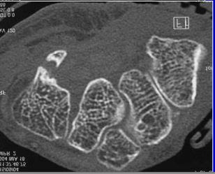 Un médecin du sport vous informe