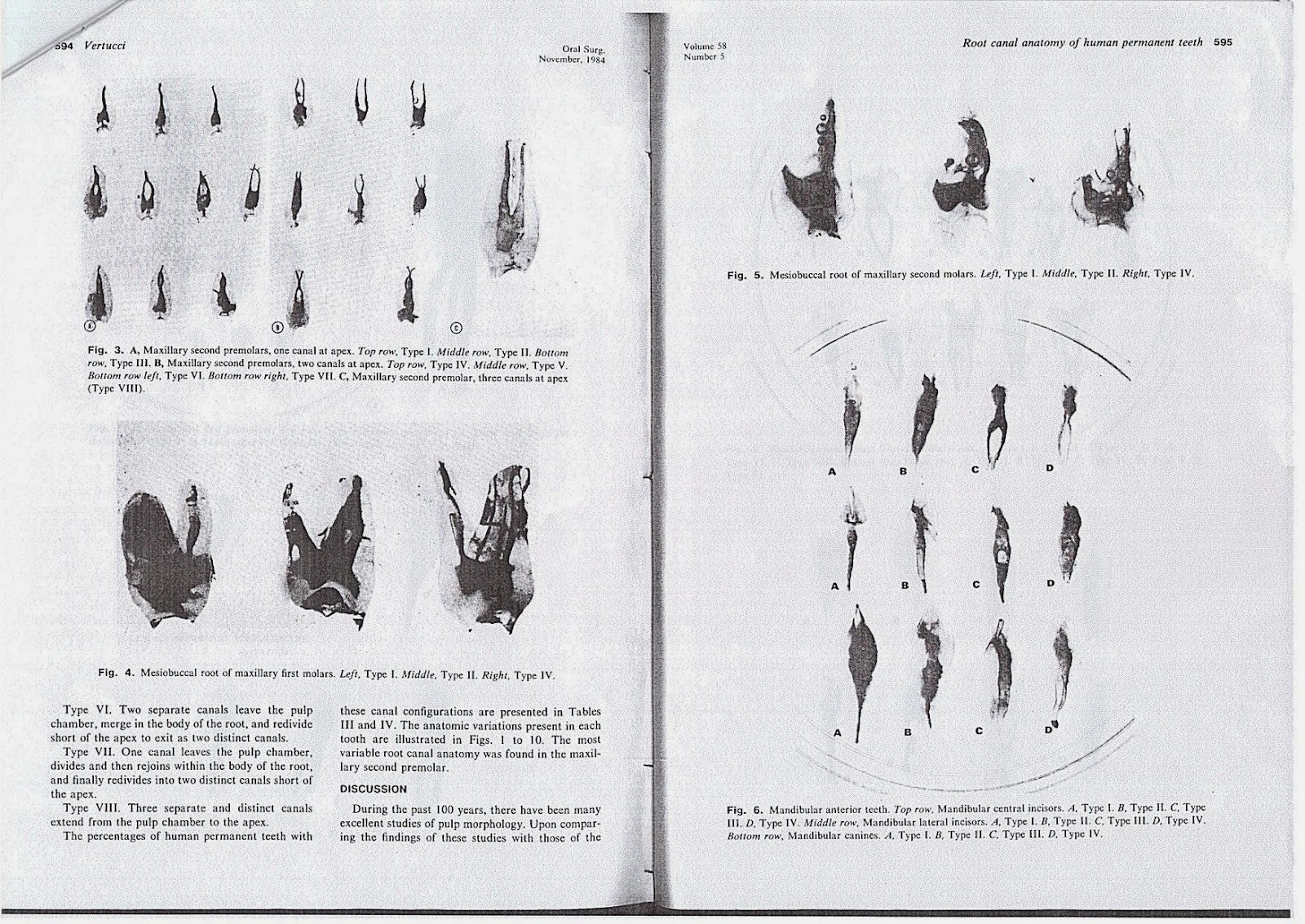 Endodoncia Microscópica en Zaragoza: Root canal anatomy of the human ...