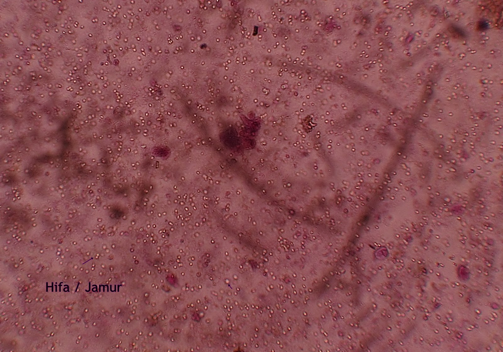 Sedimen Urine Metode Pewarnaan (Stainning) | Analis Kesehatan