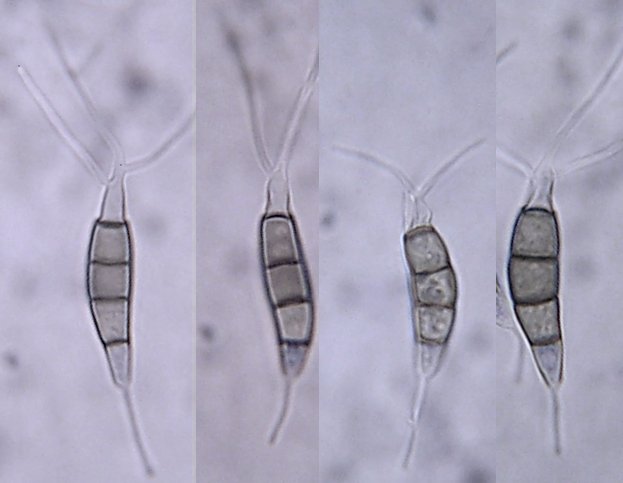 The Mycelium Connection: Pestalotiopsis Gets a Backbone
