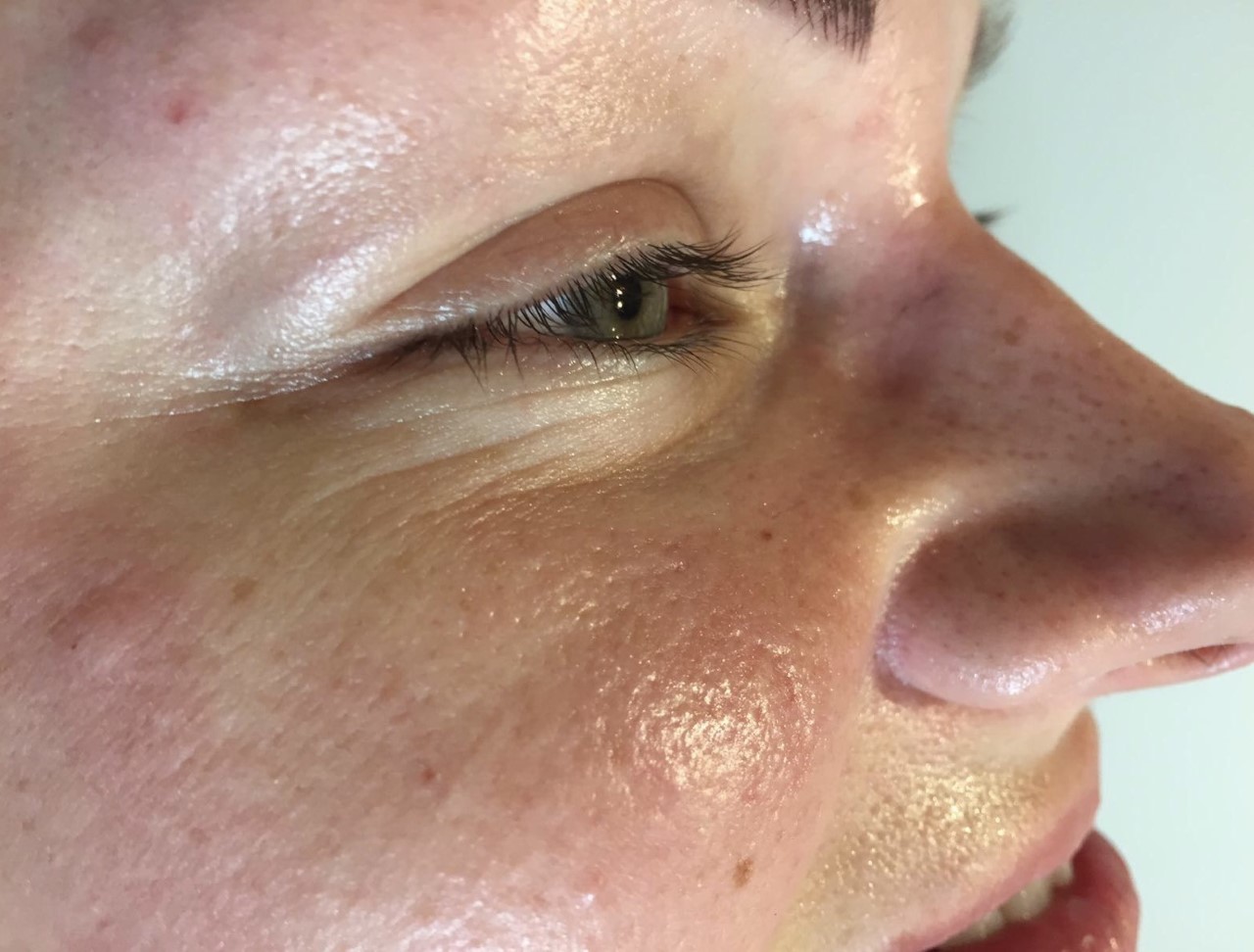 I've been Botoxed | Mimí Jasmin