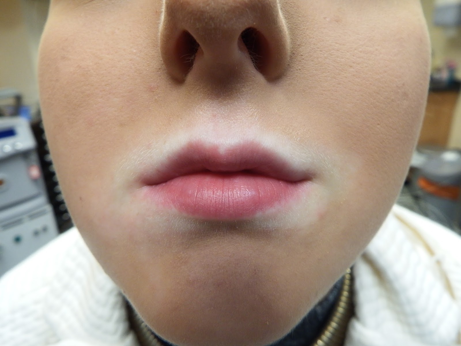 Selston Cosmetic Clinic: Botox - Vaser Lipo - Lip Enhancement - Laser ...