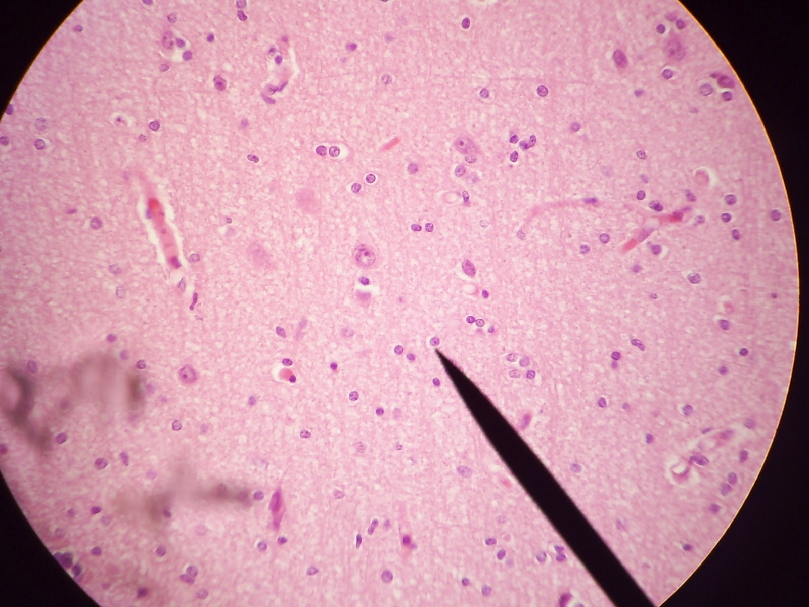 MEDICINA USMP: FOTOS DE HISTO SISTEMA NERVIOSO