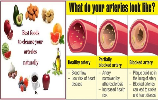 rainbowdiary: Best Foods To Cleanse Arteries Naturally