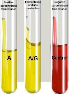 Phenol Red Fermentation Test – Principle, Procedure, Uses and ...