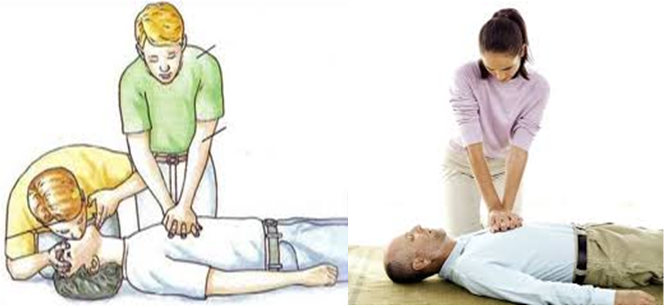 Pertolongan Pertama Gawat Darurat (PPGD) - Prosedur CPR dengan DR.CAB