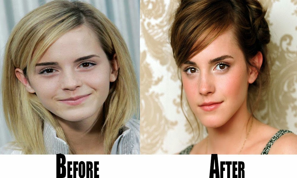 Celebrity Without Makeup Before And After