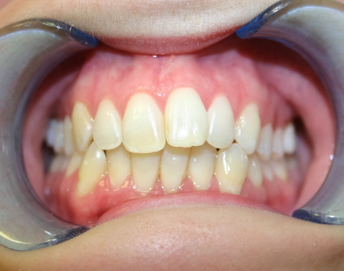 Crescent Dental on Blogspot!