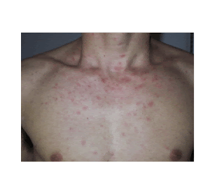 EL RINCÓN DE LA MEDICINA INTERNA. juanpedromacaluso@yahoo.com.ar ...