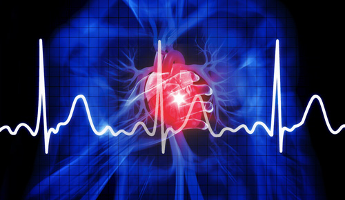 Welcome To Blaco Smiles Blog: Sudden cardiac arrest versus a Heart Attack