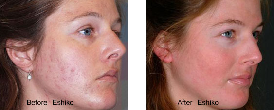 Make Up Revolutions: Eshiko - Hydrated Silica Face Powder Review