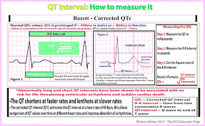 ECG Educator Blog : How to calculate the QTc (Bazett's Formula)