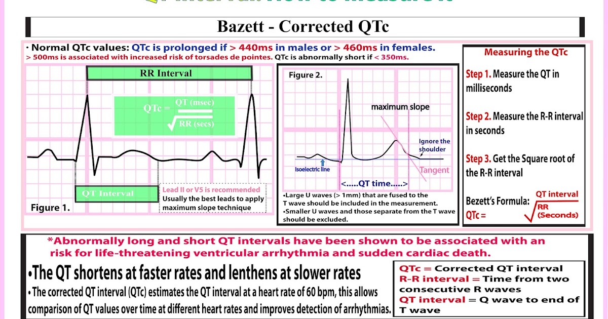 ECG Educator Blog : How to calculate the QTc (Bazett's Formula)