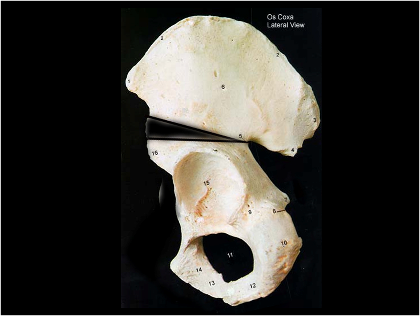 orthopedic chirugus: OSTEOTOMIES AROUND HIP