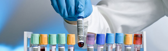 Investigación Interactiva AQB: EXÁMENES DE LABORATORIO MÁS FRECUENTES ...