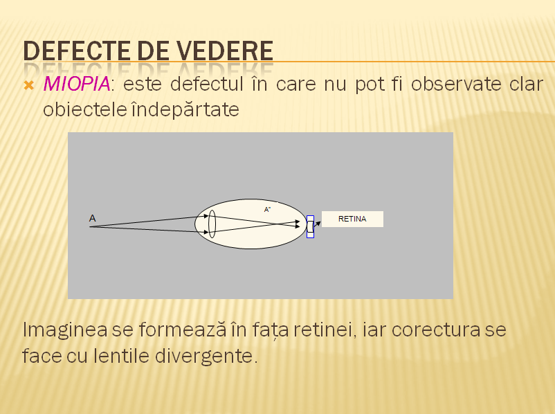 FIZICA INTERACTIVA: Proiect didactic - Ochiul. Ochelarii. Lupa.