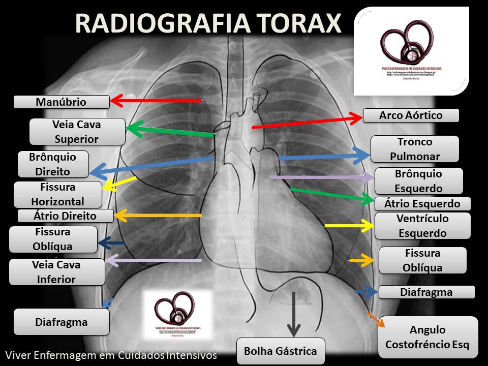 Anatomia Radiologica Do Torax - BRAINCP
