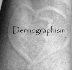 The Dreamer: Facing the Giants