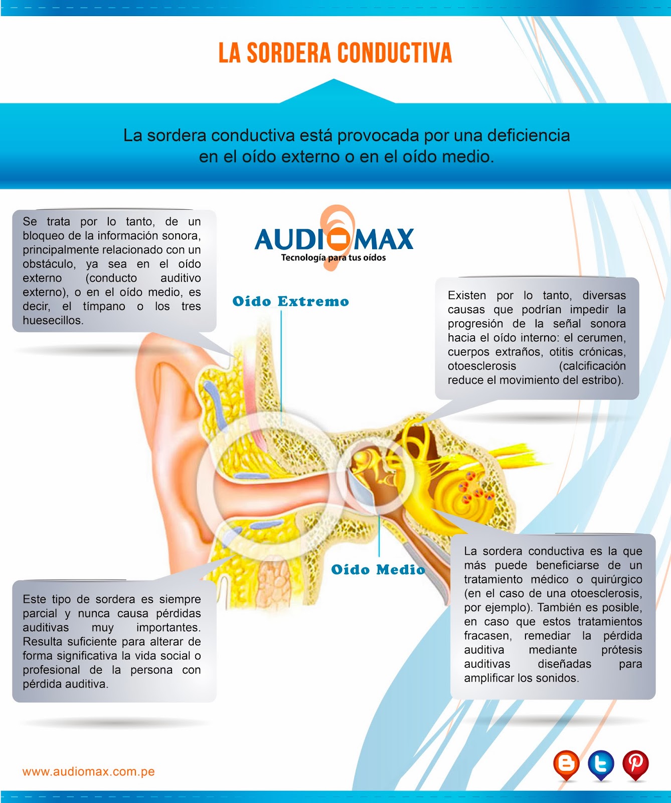 Audiomax: La Sordera Conductiva