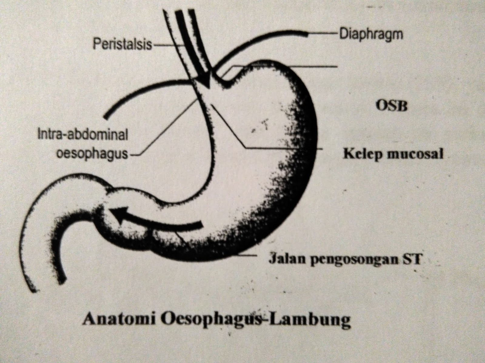 AKUPUNKTUR di BOULEVARD BUKIT RIVARIA DEPOK: Gastro Esophageal Reflux ...