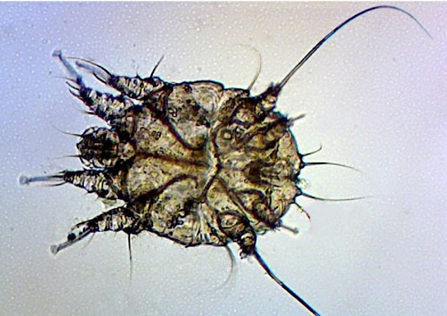 Island Urgent Care Blog: Medical Monday: How Scary is Scabies?