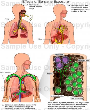 Organic Chemistry in My Daily Life: Benzene, the Lethal Weapon.