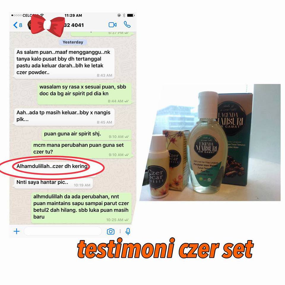 HILANGKAN PARUT DENGAN CZER SCAR POWDER