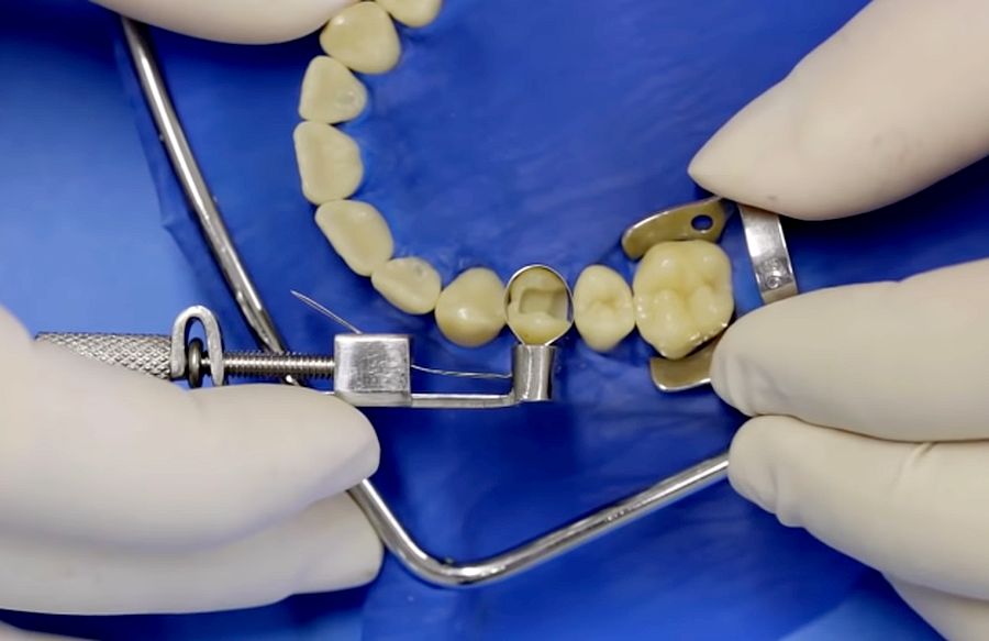 DENTÍSTICA: Utilização do porta-matriz universal - Odonto-Tv