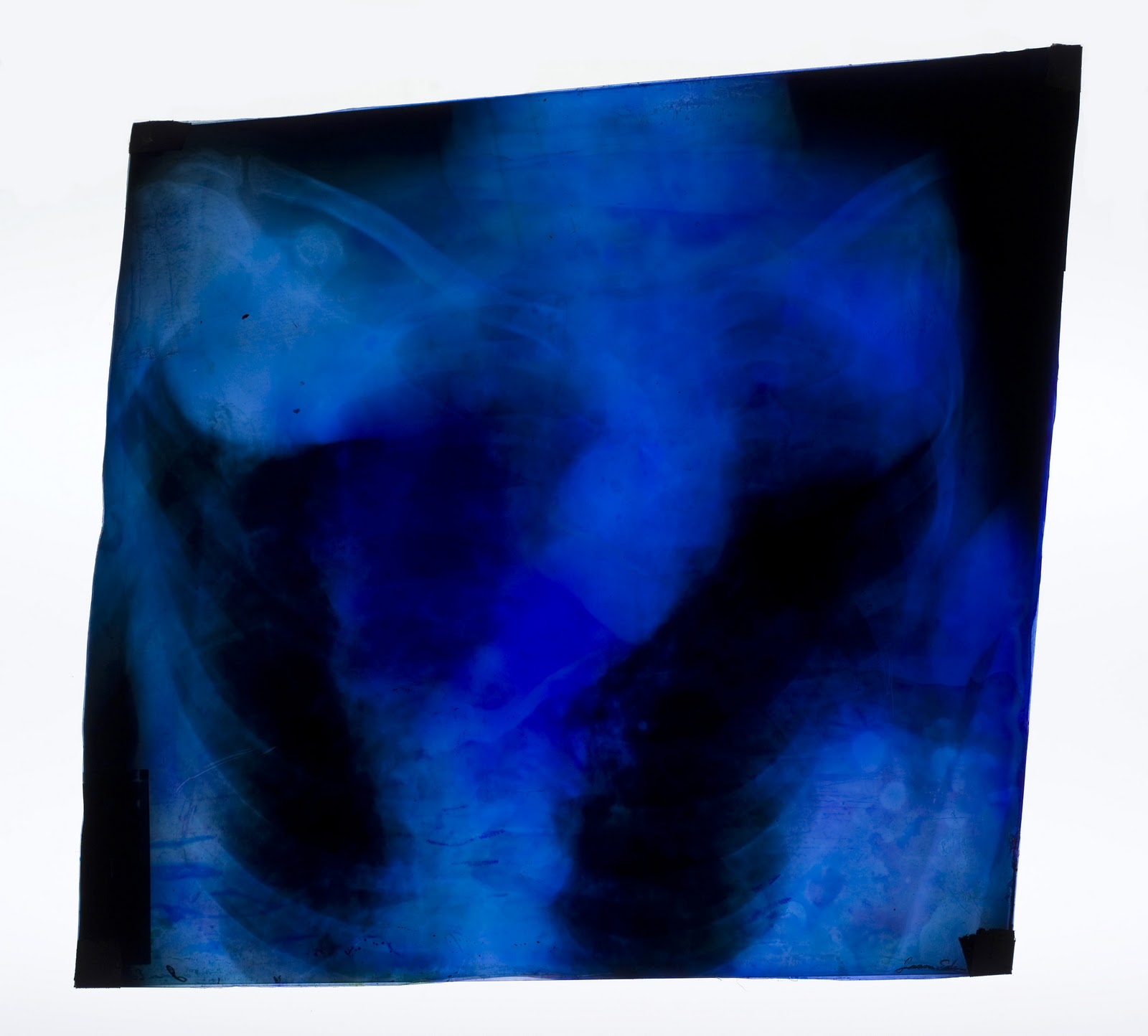 Jason Eden: X - Rays