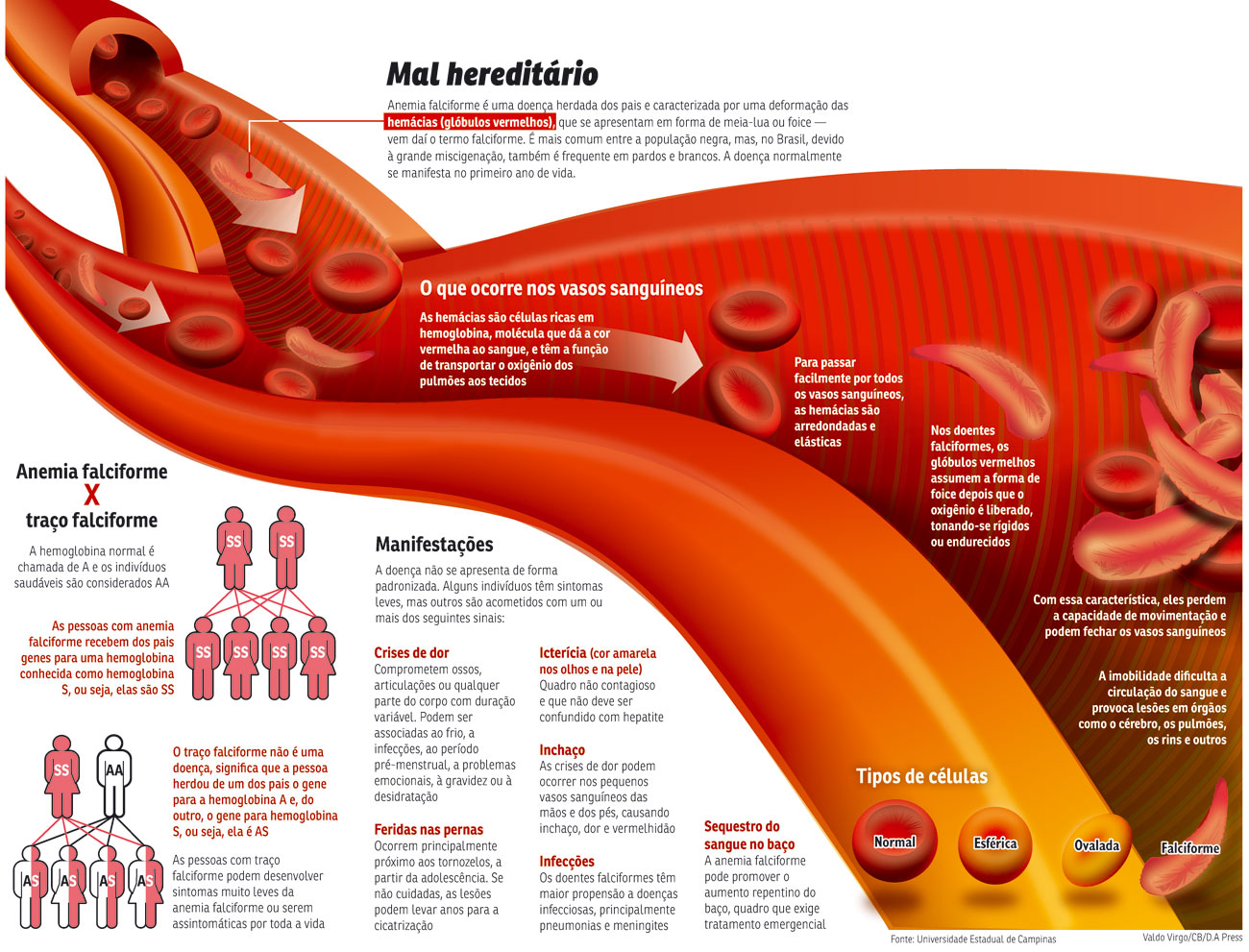 Hemoglobina Falciforme; Hemoglobinas S
