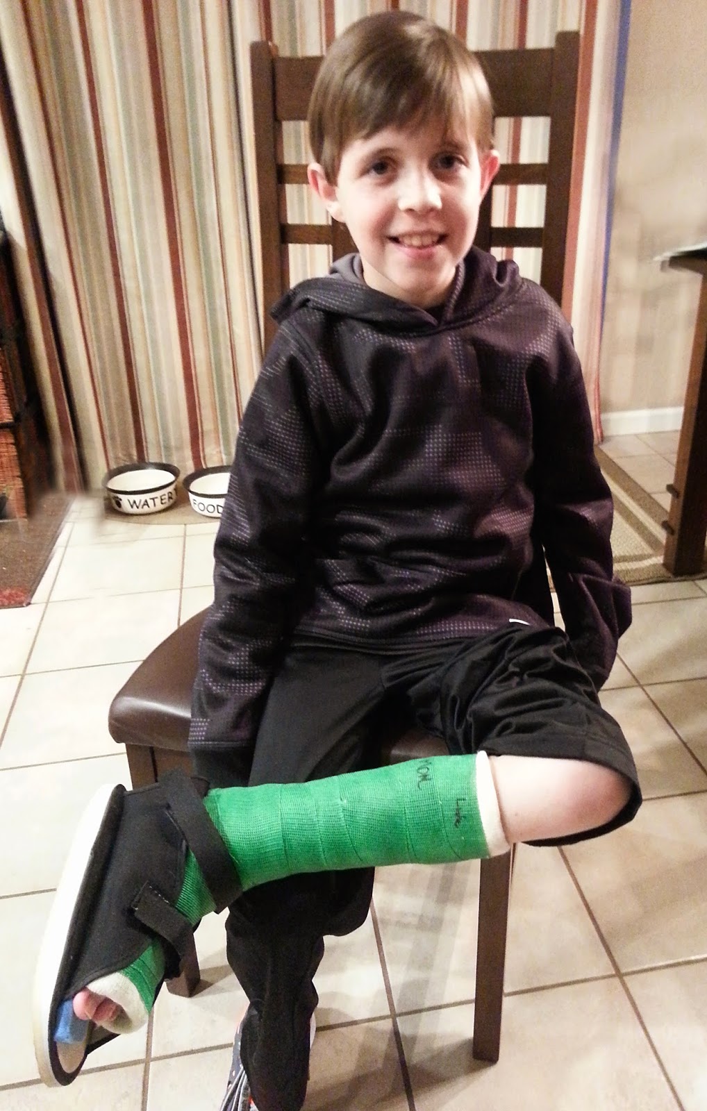 Updates on Jake: Serial Casting