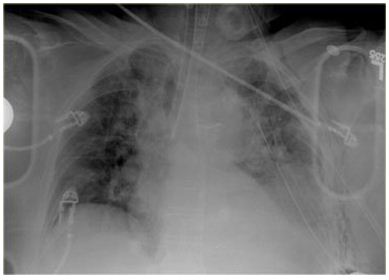 Dr Herry Setya Yudha Utama SpB. FInaCS. MHKes. ICS: TRAUMATOLOGY SERIES ...