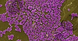 Lab Diagnosis Of S Pneumoniae -Optochin Disk Test-Quellung Test