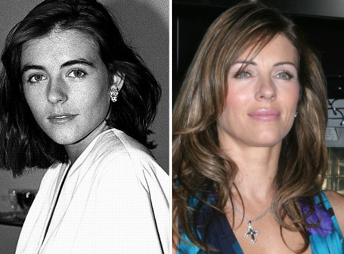 Elizabeth Hurley Plastic Surgery