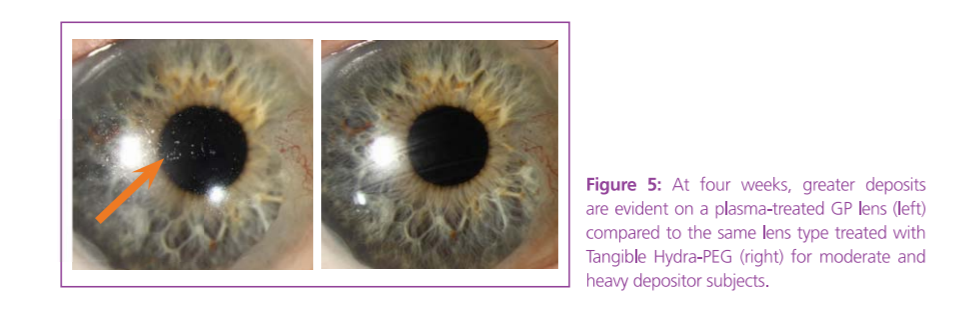 Cloudy with a Chance of Fog: Today's Best Options for Fighting Contact ...