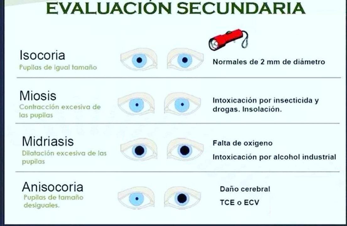 Teamwork Medical Nurse: EVALUACIÓN DE PUPILAS: REFLEJOS