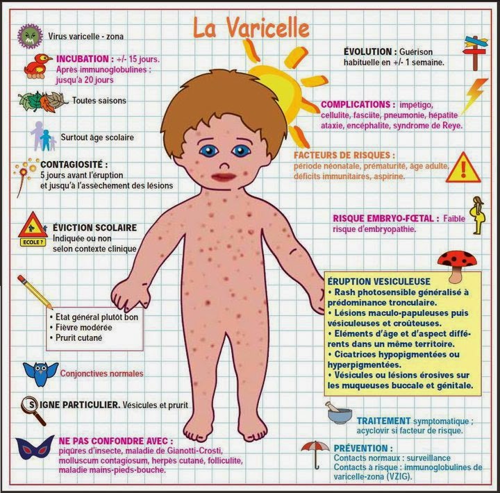 Après la scarlatine, voici la varicelle