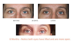 Anti-Ageing Beauty Solutions: Tua Viso Before and After Photos!