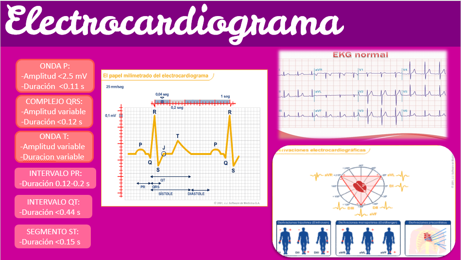 Yolva de Fisiologia: Electrocardiograma e Interpretacion de EKG.