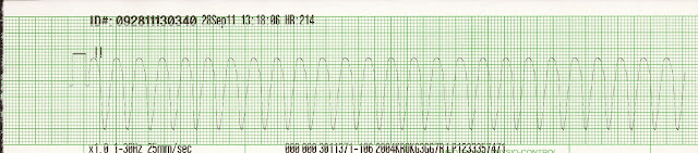 Float Nurse: ACLS review: Pulseless VF/VT Part 1