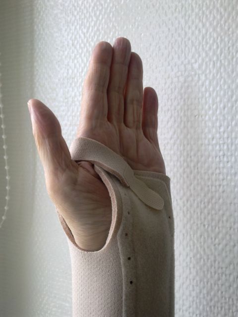 Handrehabilitationcase with Dupuytren's contracture.: A trauma in the ...