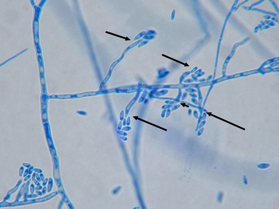 Fun With Microbiology (What's Buggin' You?): Fusarium oxysporum