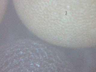 Under the Microscope