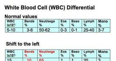 Ripani Musyaffa Ahdanlab Blog: IT RATIO (IMMATURE GRANULOCYTE)
