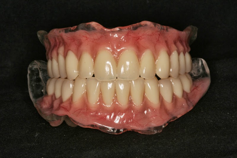 KR Odontologia: Prótese Total