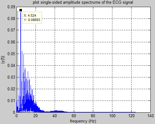 Biomedical Signal and Image Processing projects using Matlab and ...