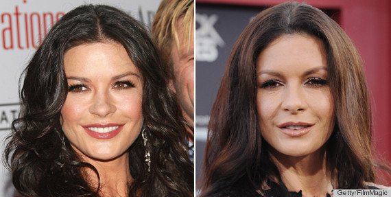 Catherine Zeta Jones Plastic Surgery Before and After Botox, Nose Job ...