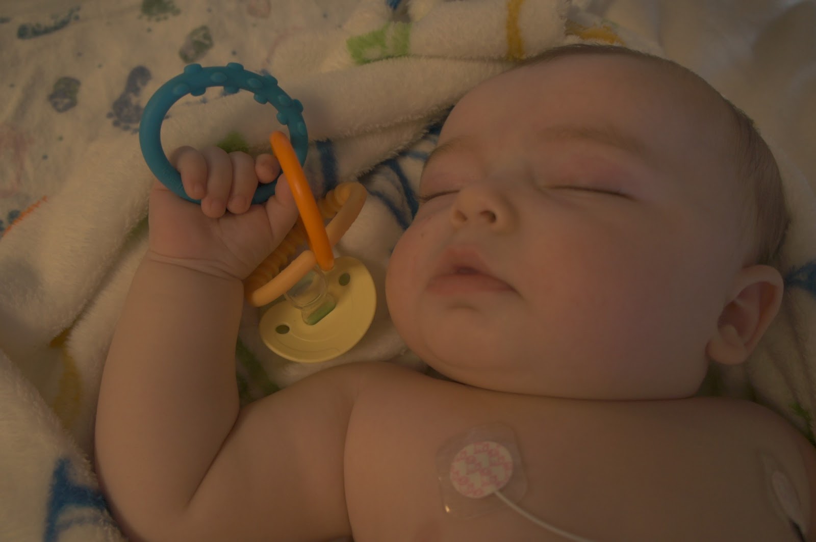 C, G & Mr. B: Family, Friends & Fun: Super Pooper: Colostomy Takedown ...