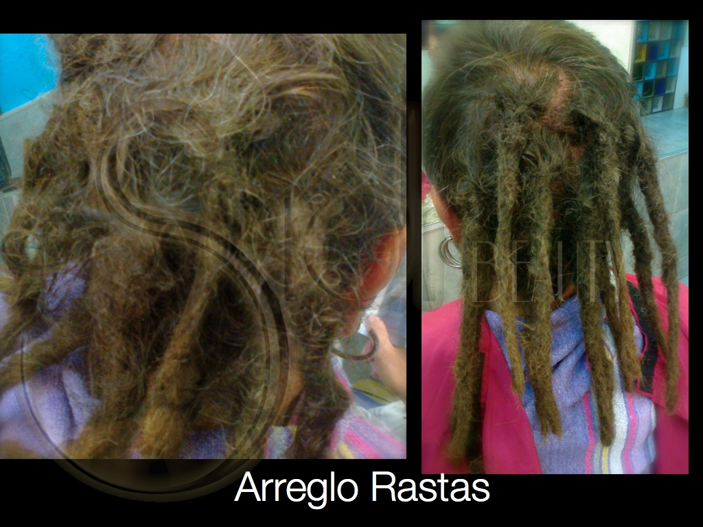 Arreglo de RASTAS